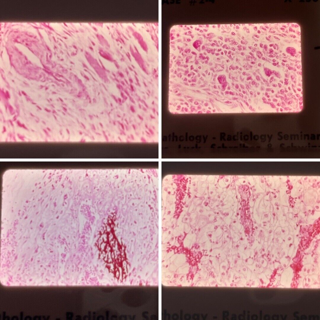 1980s X-ray Blood Cells Body ODD Weird Creepy 35mm Slide Hollywood 20 ...