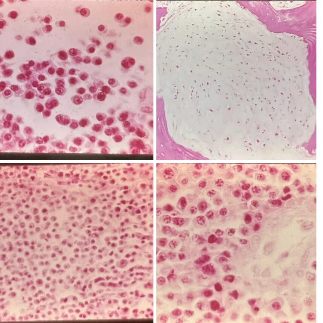 1980s X-ray Blood Cells Body ODD Weird Creepy 35mm Slide Hollywood 20 ...